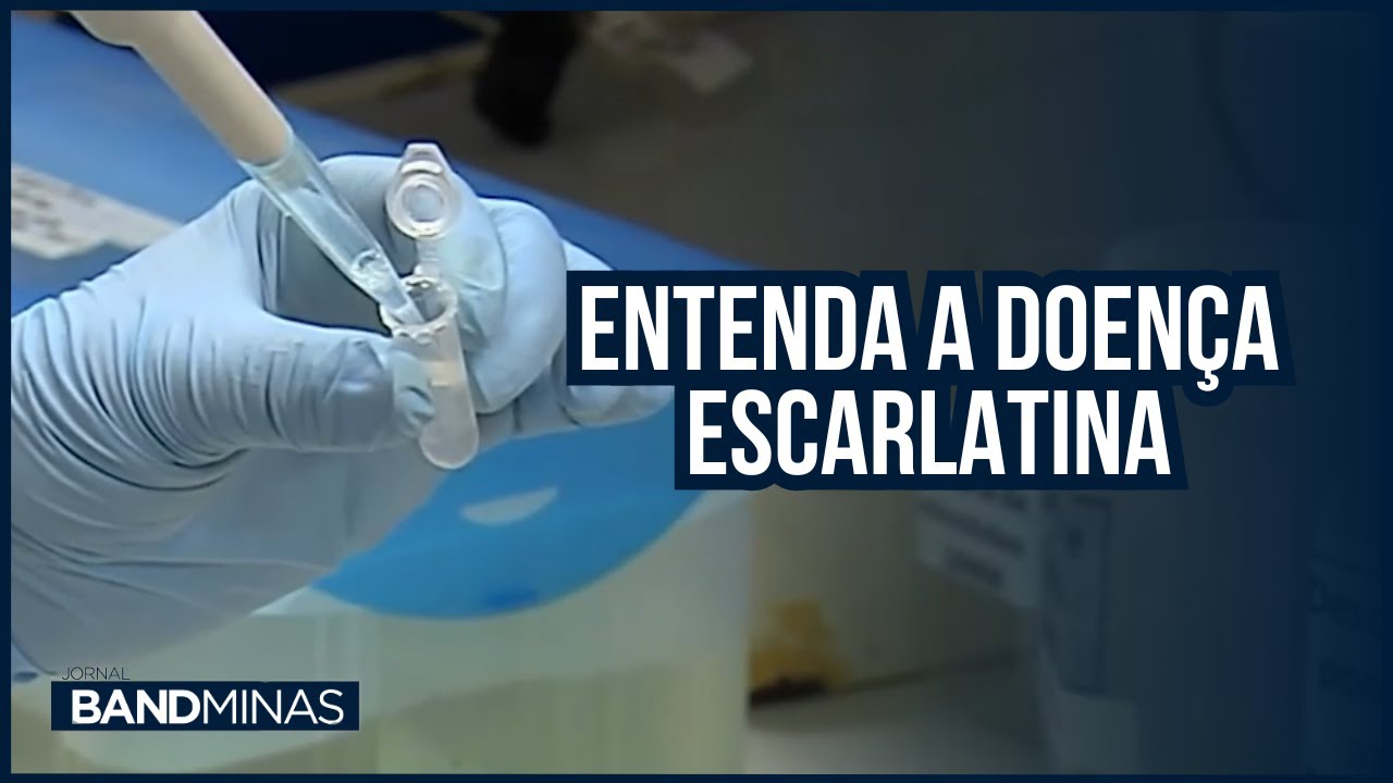 ENTENDA A ESCARLATINA, DOENÇA CAUSADA PELA BACTÉRIA STREPTOCOCCUS ...
