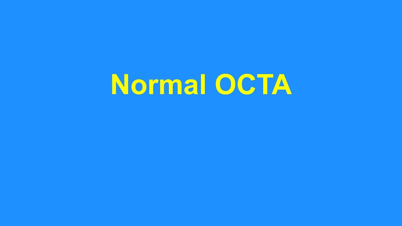 Normal OCTA - YouTube