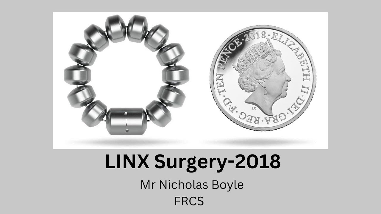 Surgeon Nicholas Boyle - LINX Surgery 2018 - YouTube