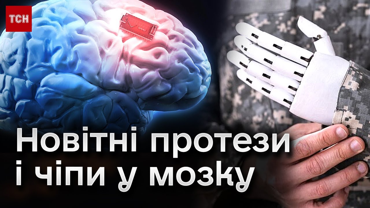 😱 Це неймовірно! Технології, які допомагають бійцям бачити та ходити ...