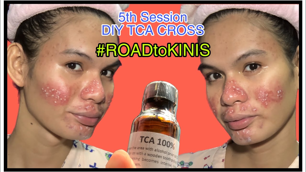 What Is TCA CROSS How TCA CROSS Work What Does TCA CROSS Do diy what-is-tca-cross-how-tca-cross-work-what-does-tca-cross-do-diy