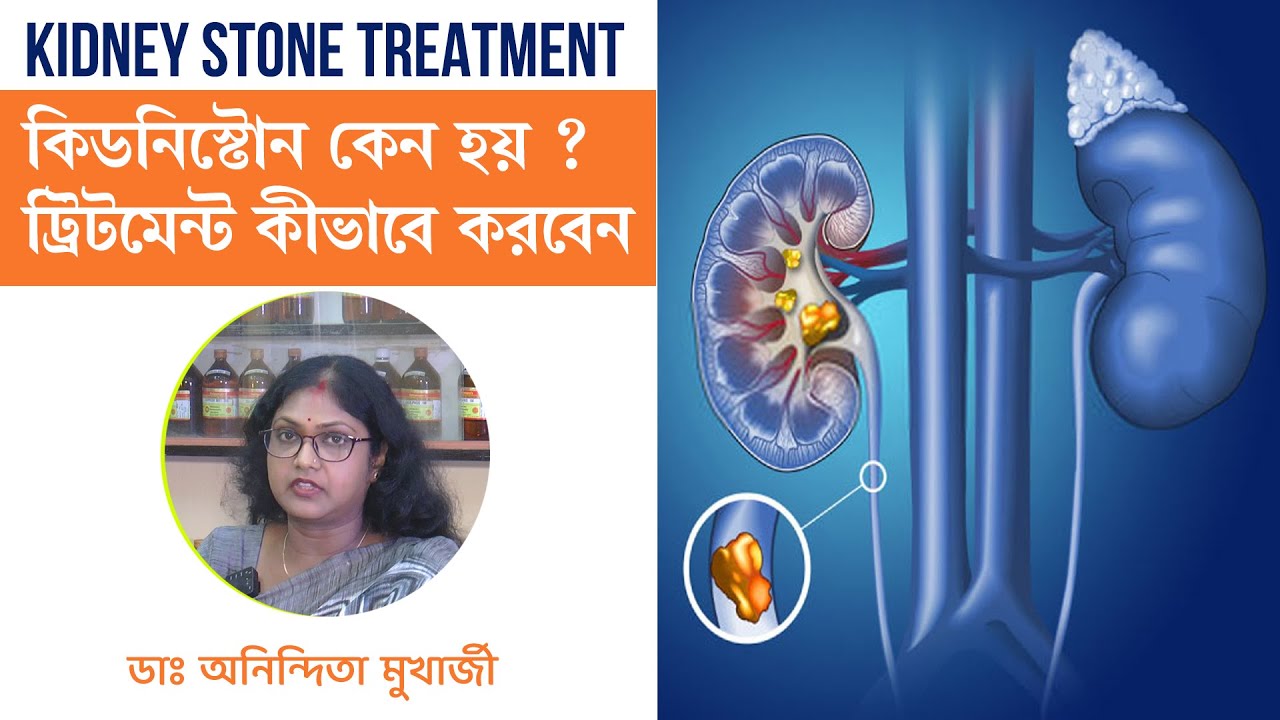 কিডনিস্টোন কেন হয়, হলে কী করবেন ? Treating Kidney stone problem in ...