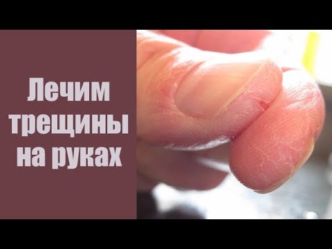 МАЗЬ ПРИ ТРЕЩИНАХ НА РУКАХ - YouTube