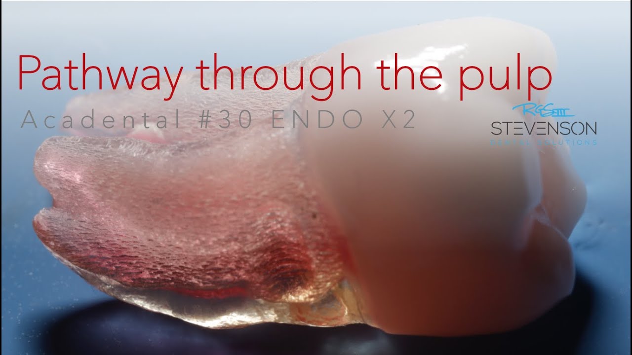 Dental Pulp - Pathway Through the Pulp - Acadental #30 - YouTube