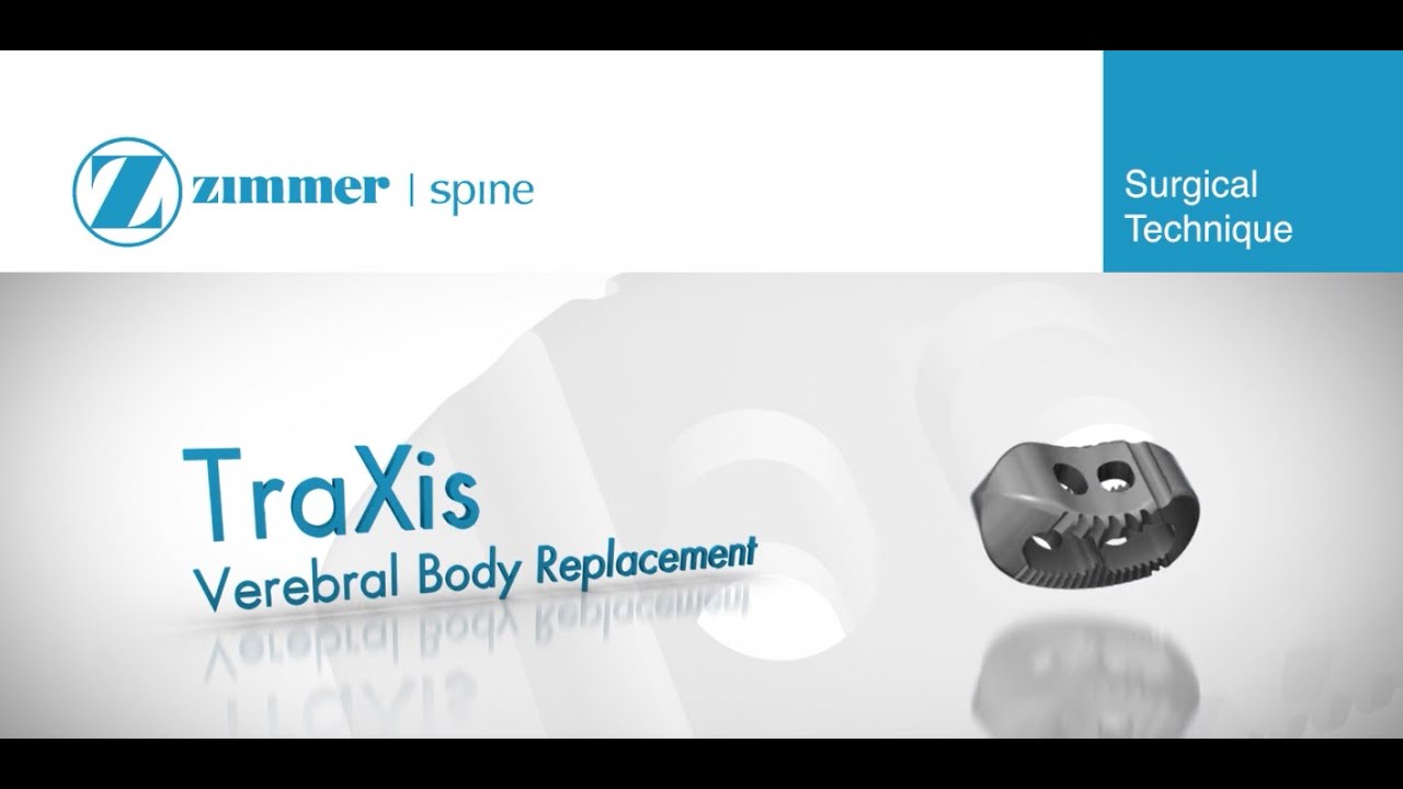 Zimmer Biomet: Traxis TLIF Cage - YouTube
