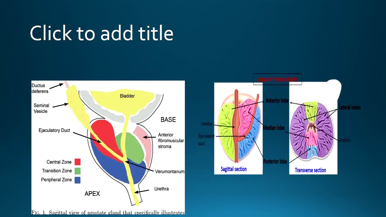 Dissection gross anatomy class by Dr. Rabia Maqsood on topic Prostate ...