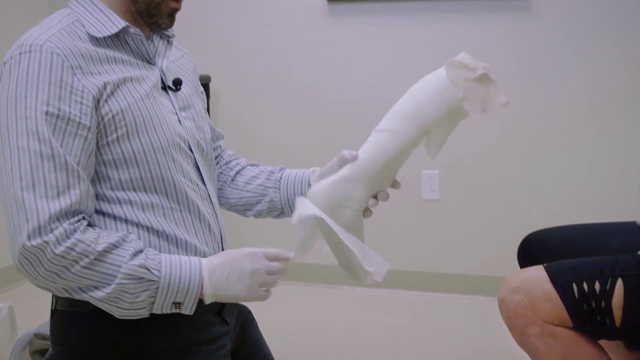 How A Custom AFO Is Made Part 1: The Casting Process - YouTube