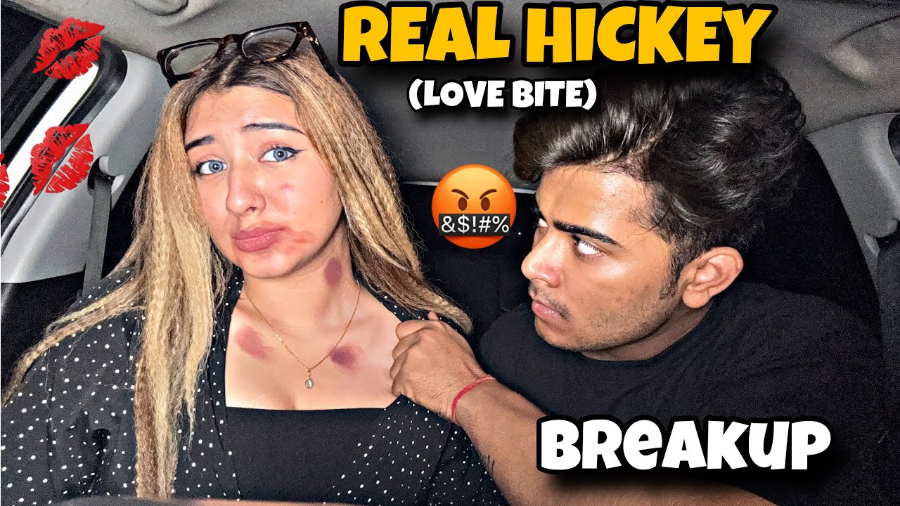 Real Hickey (Love Bite) 💋 Prank On Anmol * He Got Extremely Angry 🤬 ...