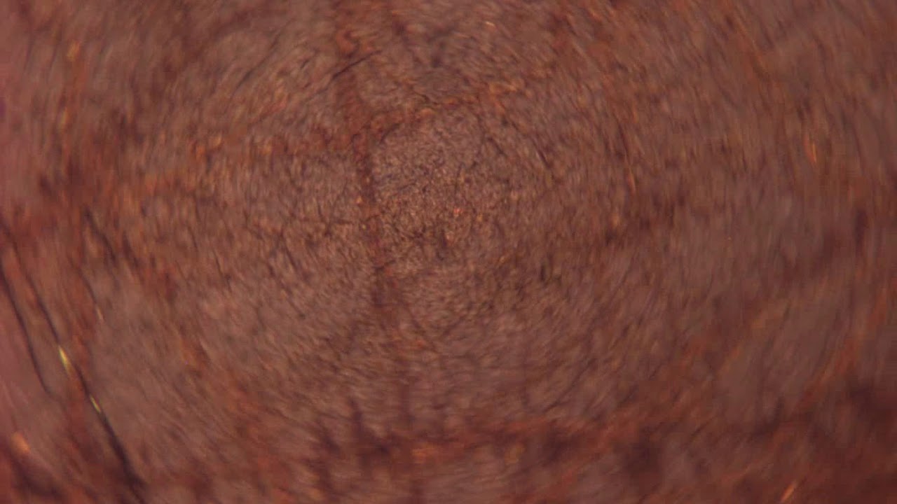 Allanite au microscope polarisant (LPA) - YouTube