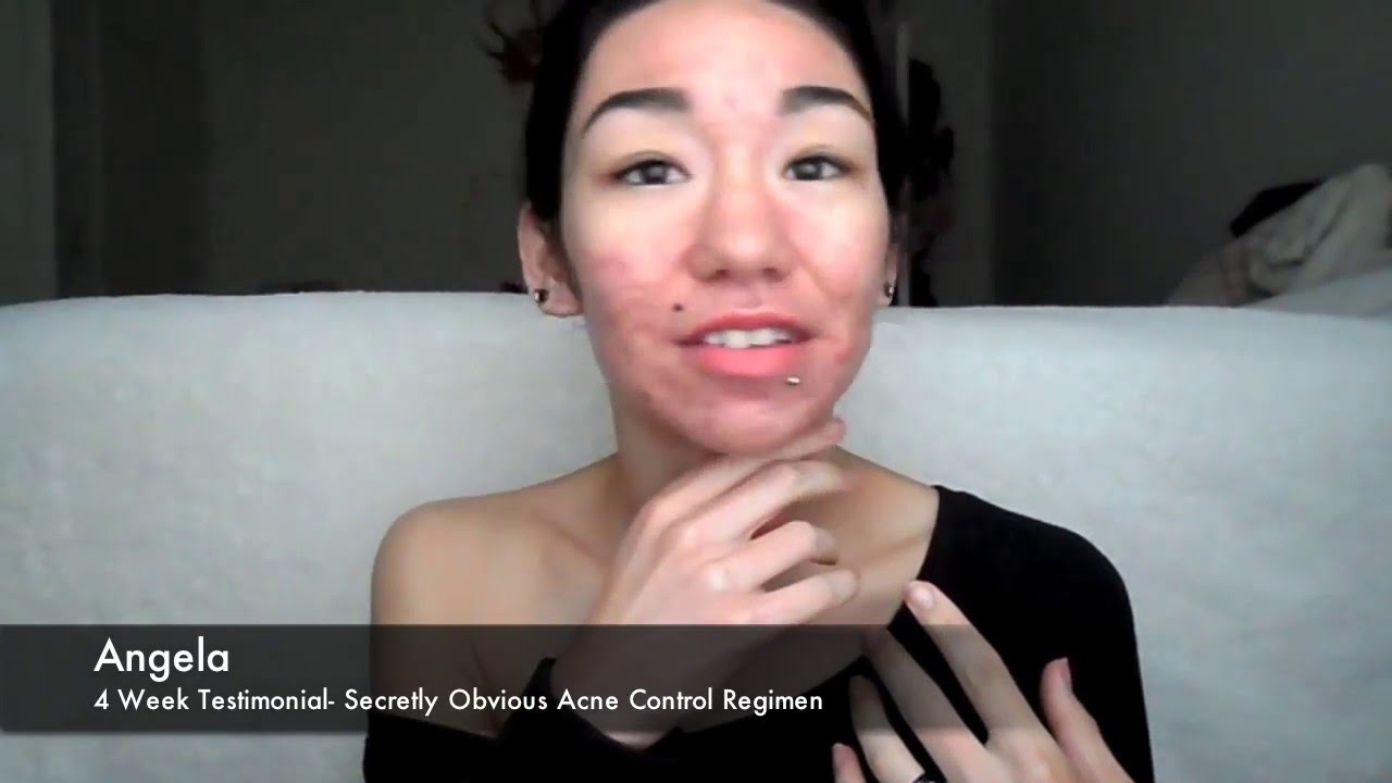 Angela's Testimonial- Secretly Obvious Essential Oil Skin care Review ...
