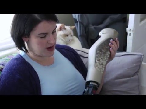 Double Amputee uses C-Leg Prosthetics - Bionic Stride [Osseointegration Doc]