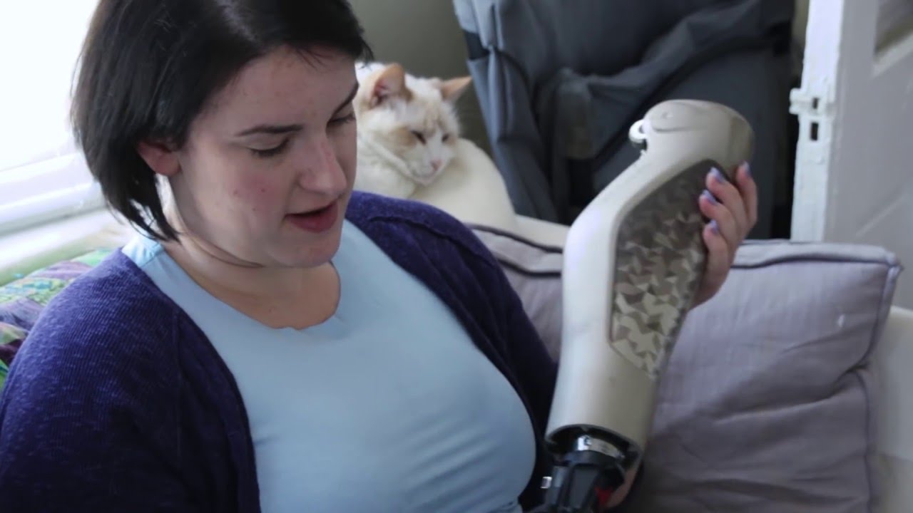 Double Amputee uses C-Leg Prosthetics - Bionic Stride [Osseointegration ...