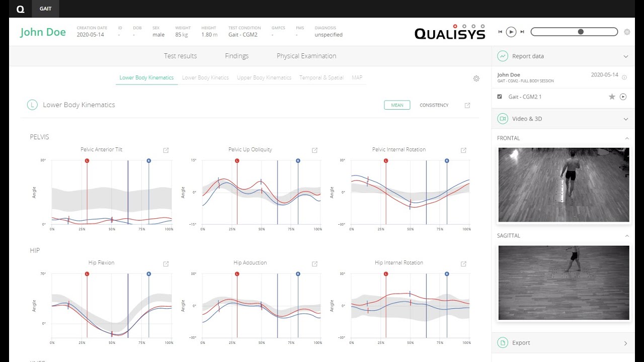 Impairment Focused Interpretation with Qualisys Gait Reports - Webinar ...