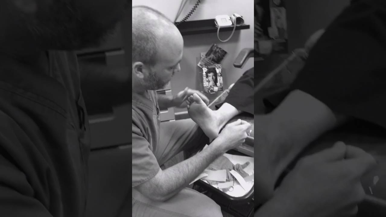 Placing a low dye strap - YouTube