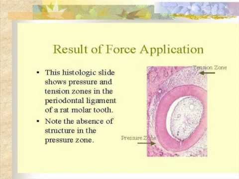 Biology of Tooth movement in orthodontics / Indian Dental Academy - YouTube