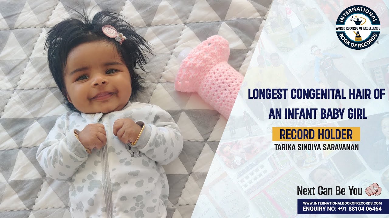 LONGEST CONGENITAL HAIR OF AN INFANT BABY GIRL - YouTube