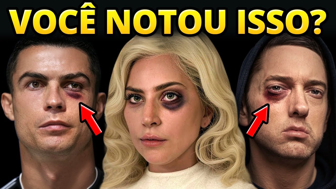 O QUE ESTÁ POR TRÁS DO OLHO ROXO DOS FAMOSOS? - Algo Muito Estranho ...