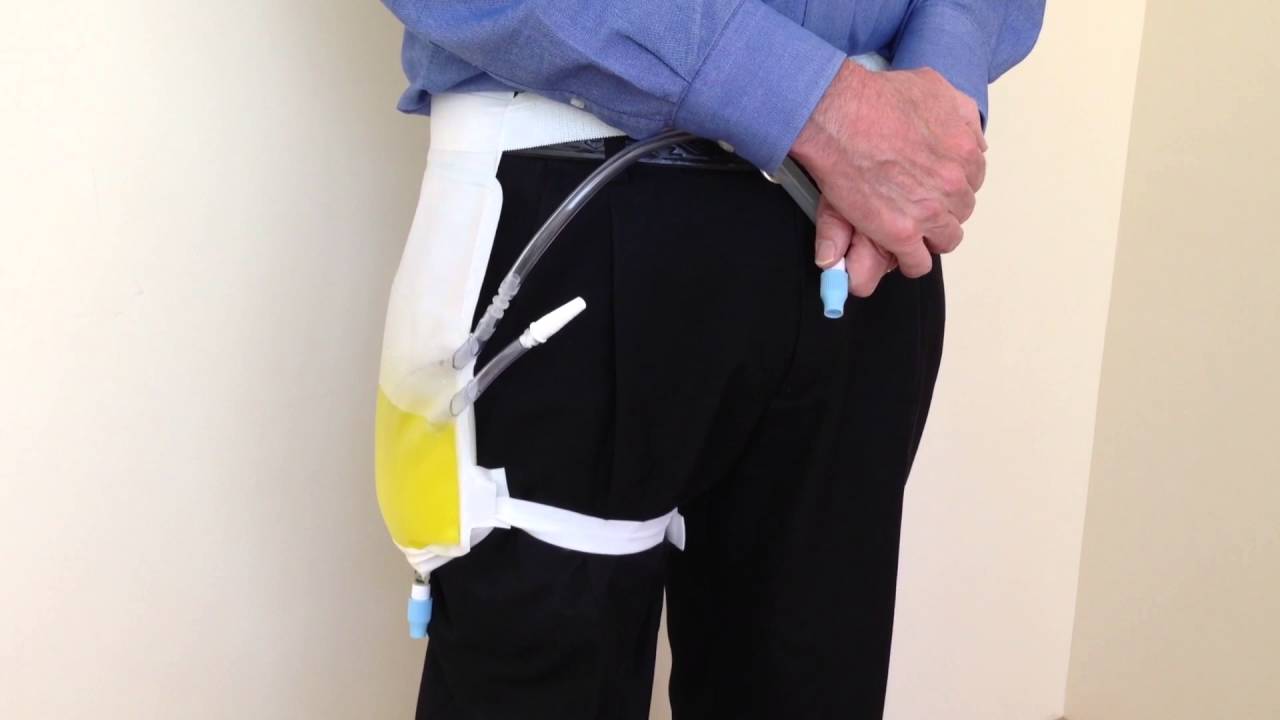 The Stand Tall Urinary Management System - YouTube