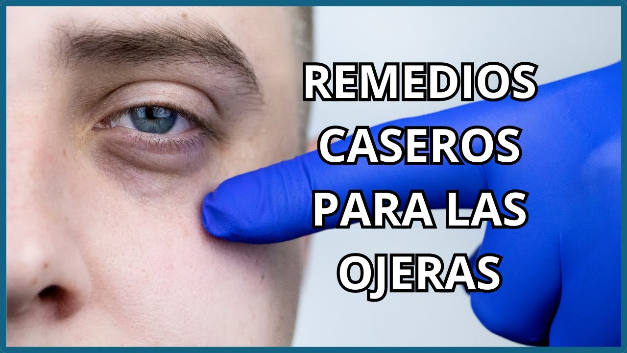 Remedios caseros para eliminar las ojeras - YouTube