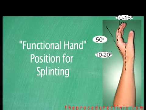 Ulnar & Radial Gutter Forearm Splint Application - YouTube