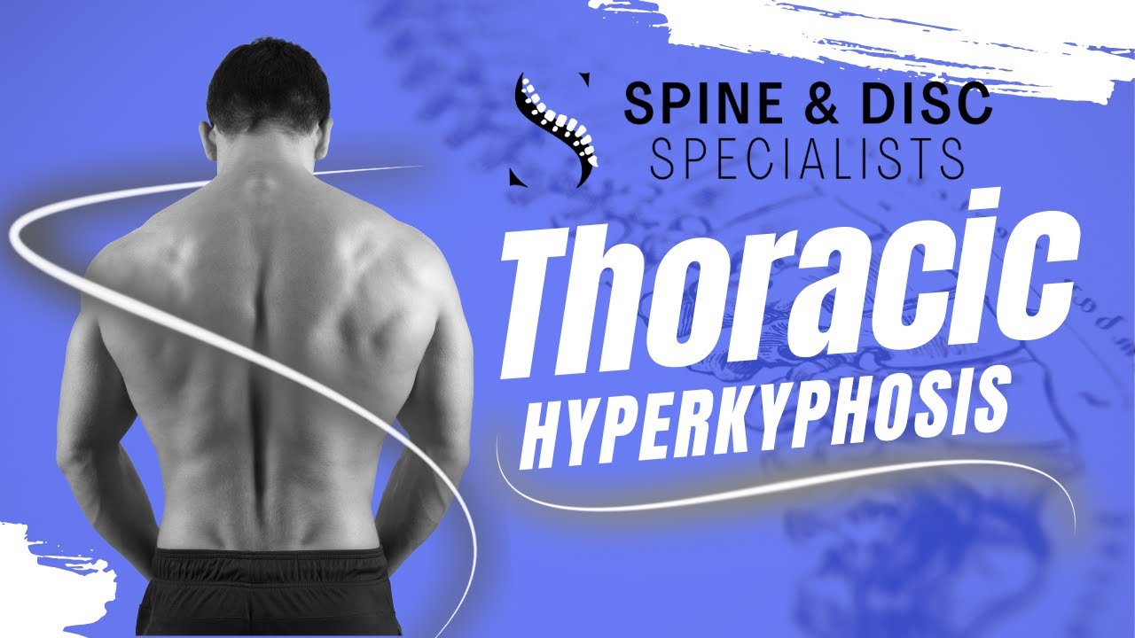 Thoracic Hyperkyphosis | Spine & Disc Specialists [2024] - YouTube