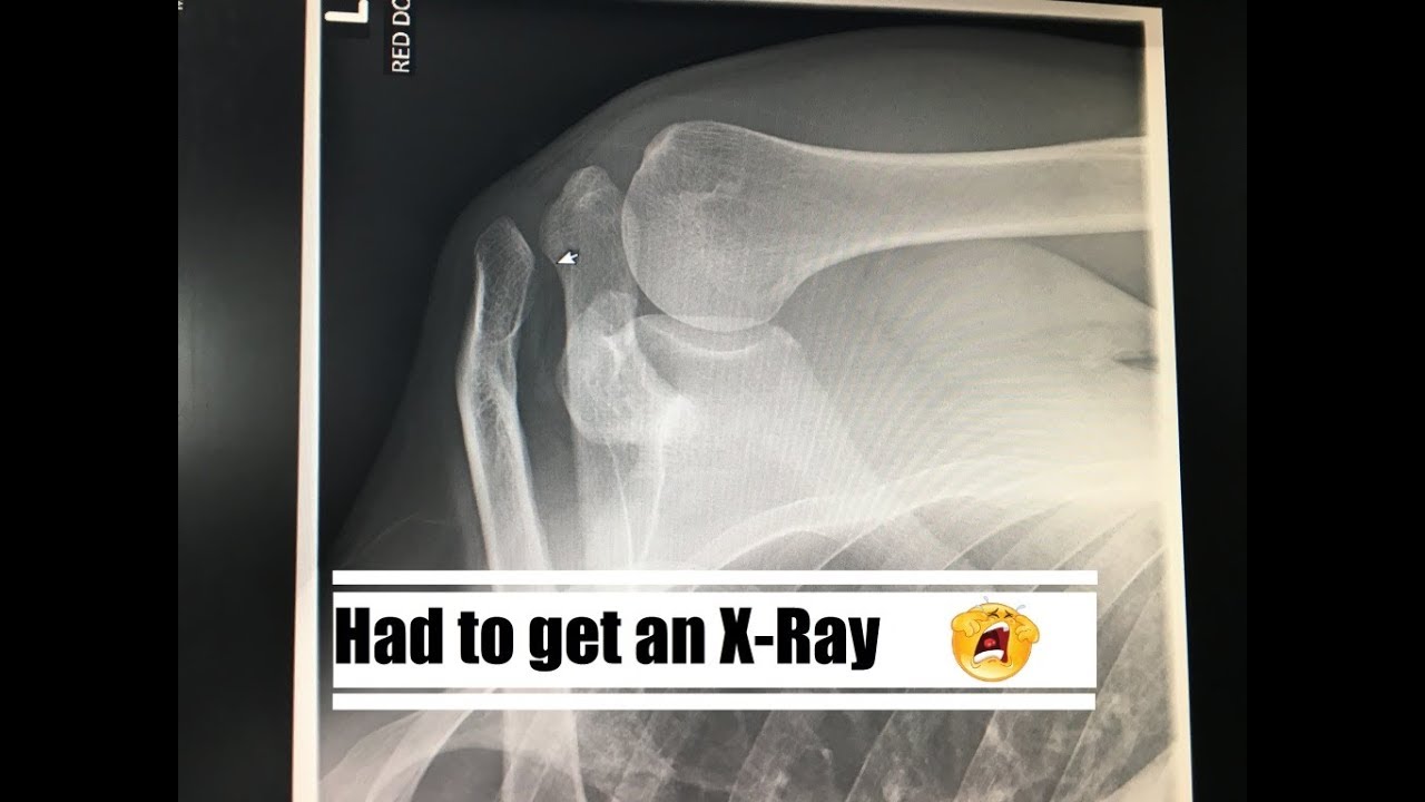 Crash at Cannock Chase Off Piste mtb blog - YouTube