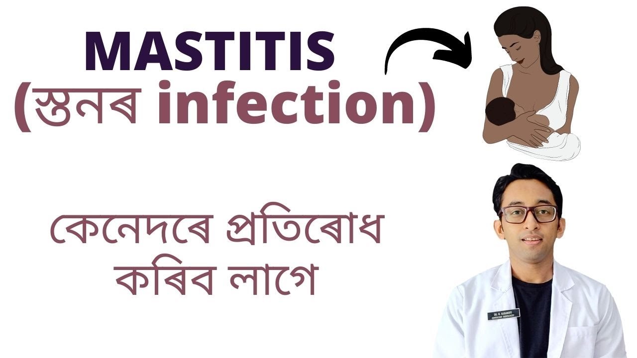MASTITIS - INFECTION OF BREAST. স্তনৰ INFECTION. DOCTOR NISHANT - YouTube