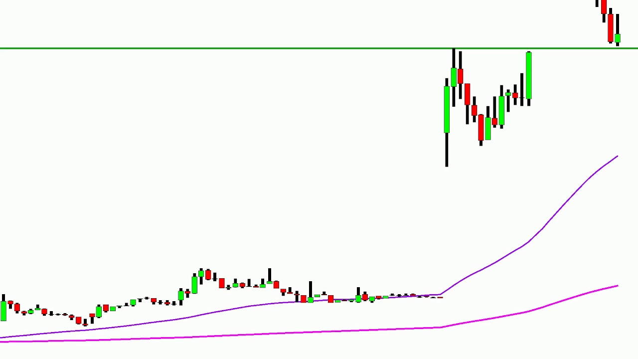 Axovant Sciences Ltd. - AXON Stock Chart Technical Analysis for 06-07 ...