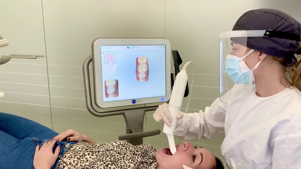 ¿Cómo funciona el escáner intraoral Ítero? - YouTube