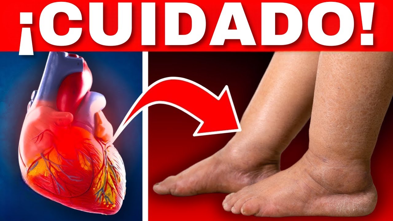 Tu CORAZÓN Puede ESTAR en PELIGRO | NO IGNORES Estas SEÑALES TEMPRANAS ...