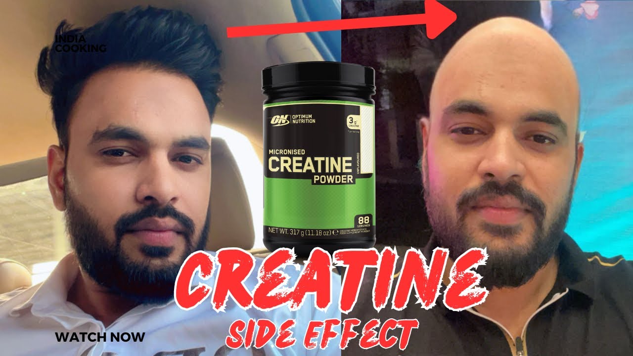 Watch This Before Taking Creatine | Side effects of Creatine | #creatine - YouTube