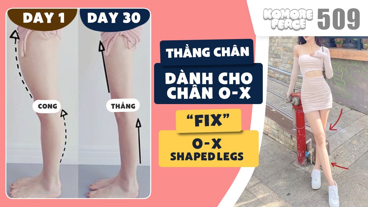 🔥THẲNG CHÂN🔥Chân cong không còn là nỗi lo với bài tập này | Fix O or X-Shaped Legs🍀Bài 509 - YouTube