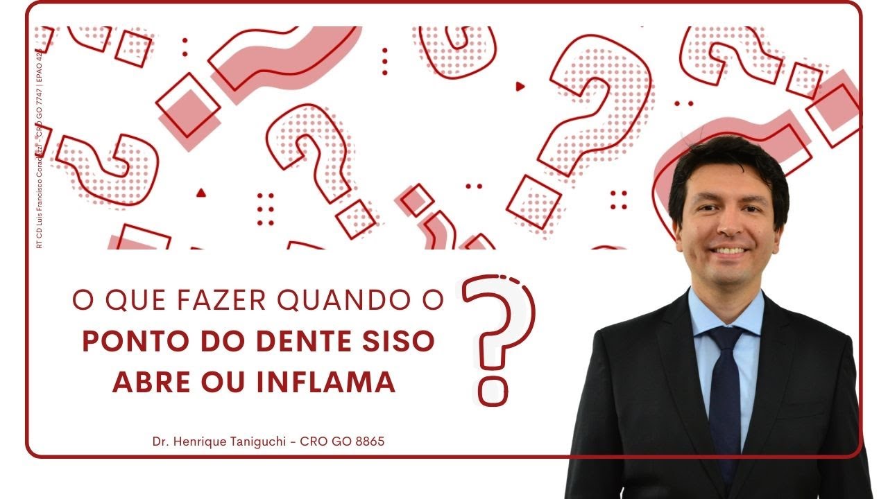 O QUE FAZER QUANDO O PONTO DE DENTE SISO ABRE OU INFLAMA? - YouTube