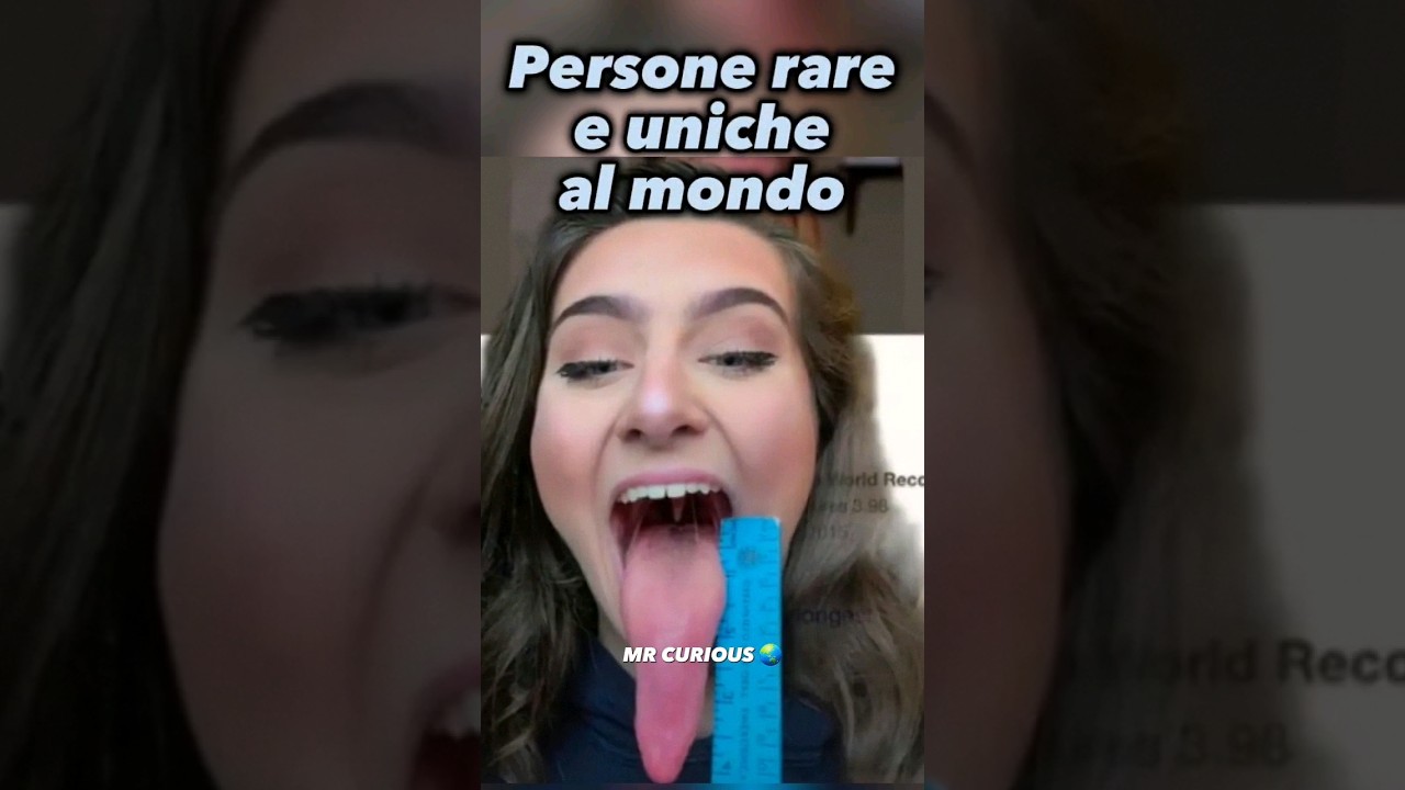 10 persone rare e uniche al mondo. #curiosità #misteri #abissi # ...