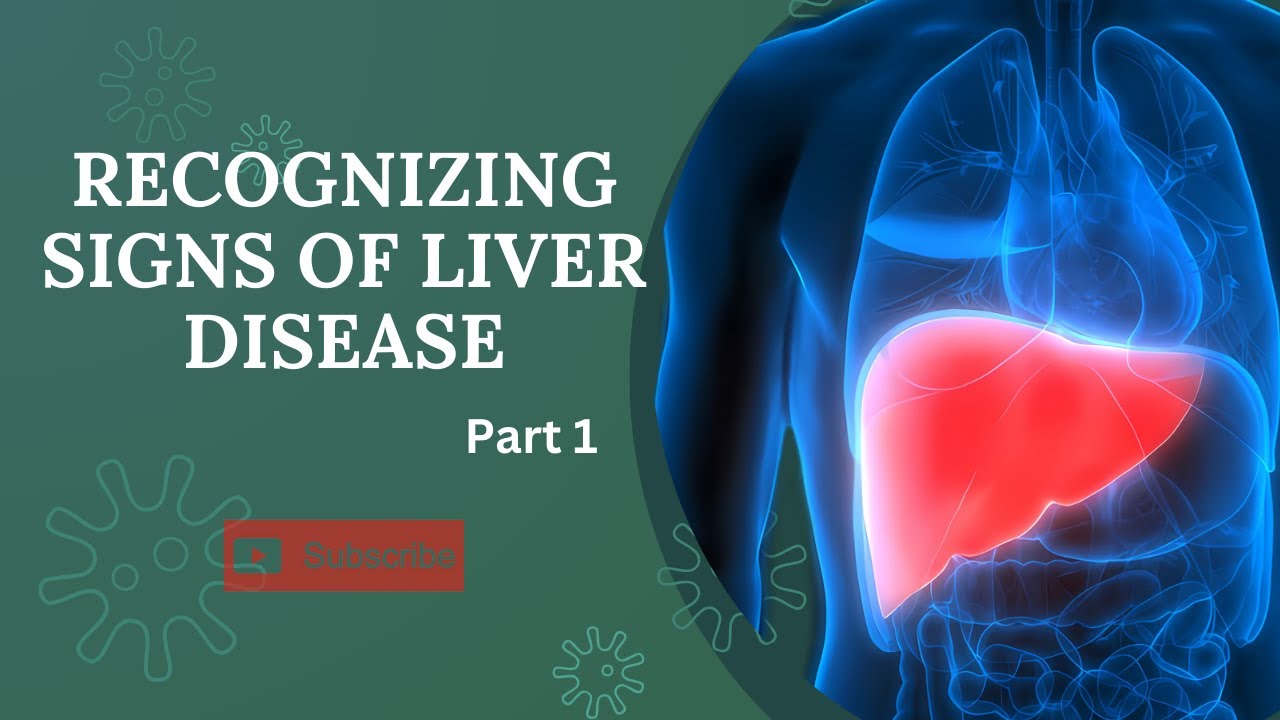Decoding liver health : Recognizing signs of liver disease - YouTube