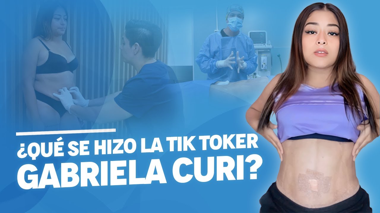 OPERAMOS A LA TIKTOKER GABRIELA CURI ¿Qué se hizo? - YouTube