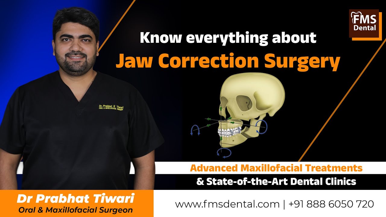 Transforming Smiles with Orthognathic Surgery | Jaw Alignment Explained ...
