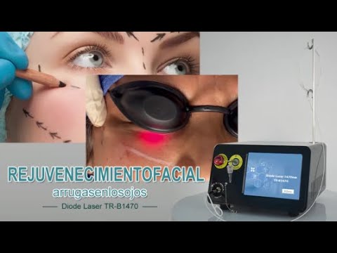 980 1470nm diode laser eye bag removal machine-TRIANGEL TR-B1470 - YouTube