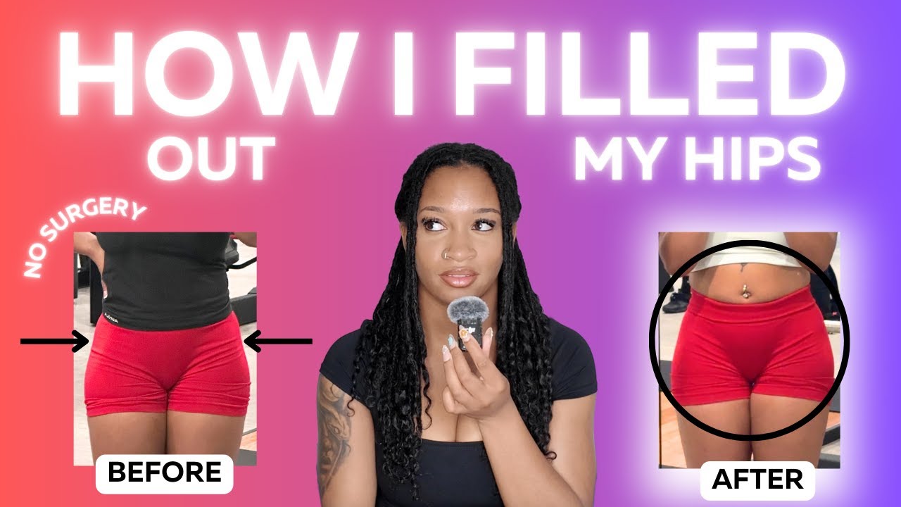 HOW I GOT RID OF MY HIPS DIPS (NO SURGERY) - YouTube