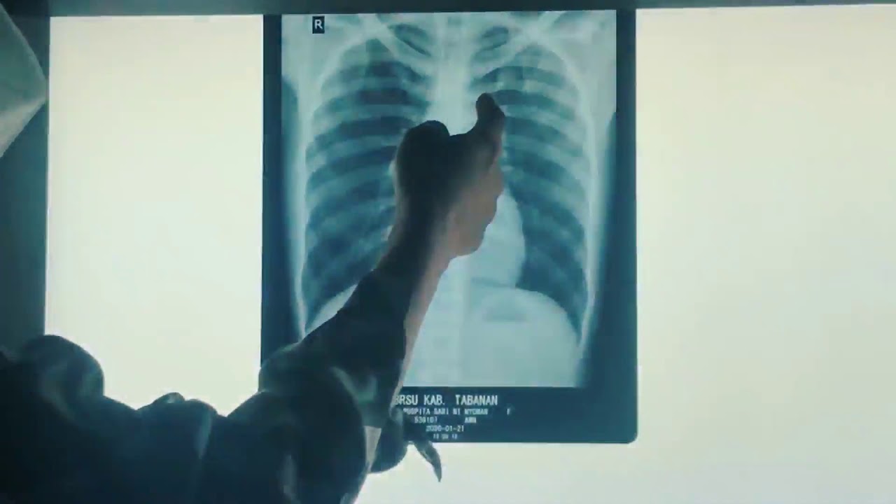INTERPRETASI FOTO RONTGEN THORAX - YouTube