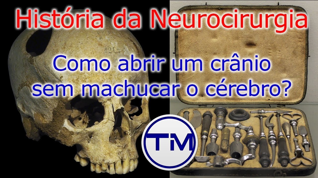 Como abrir um crânio sem machucar o cérebro? [História da Neurocirurgia ...