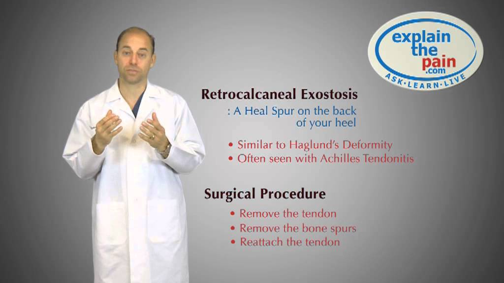Retro Calcaneal Exostosis - YouTube