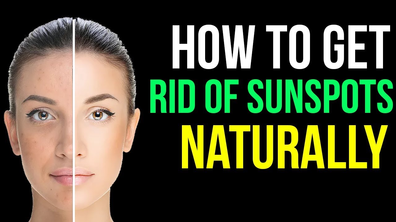 How To Get Rid Of Sunspots Naturally Best Natural Way To Get Rid Of how-to-get-rid-of-sunspots-naturally-best-natural-way-to-get-rid-of