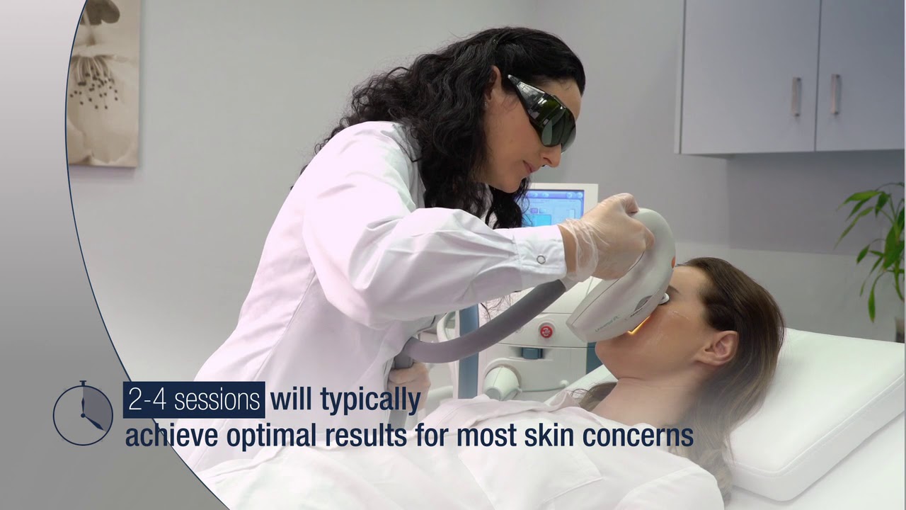Lumenis M22 IPL Skin Treatments - YouTube