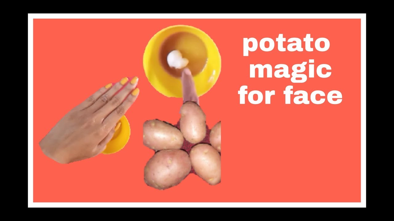 Face pack for oily skin and pimples/glycerin face pack/potato face pack ...