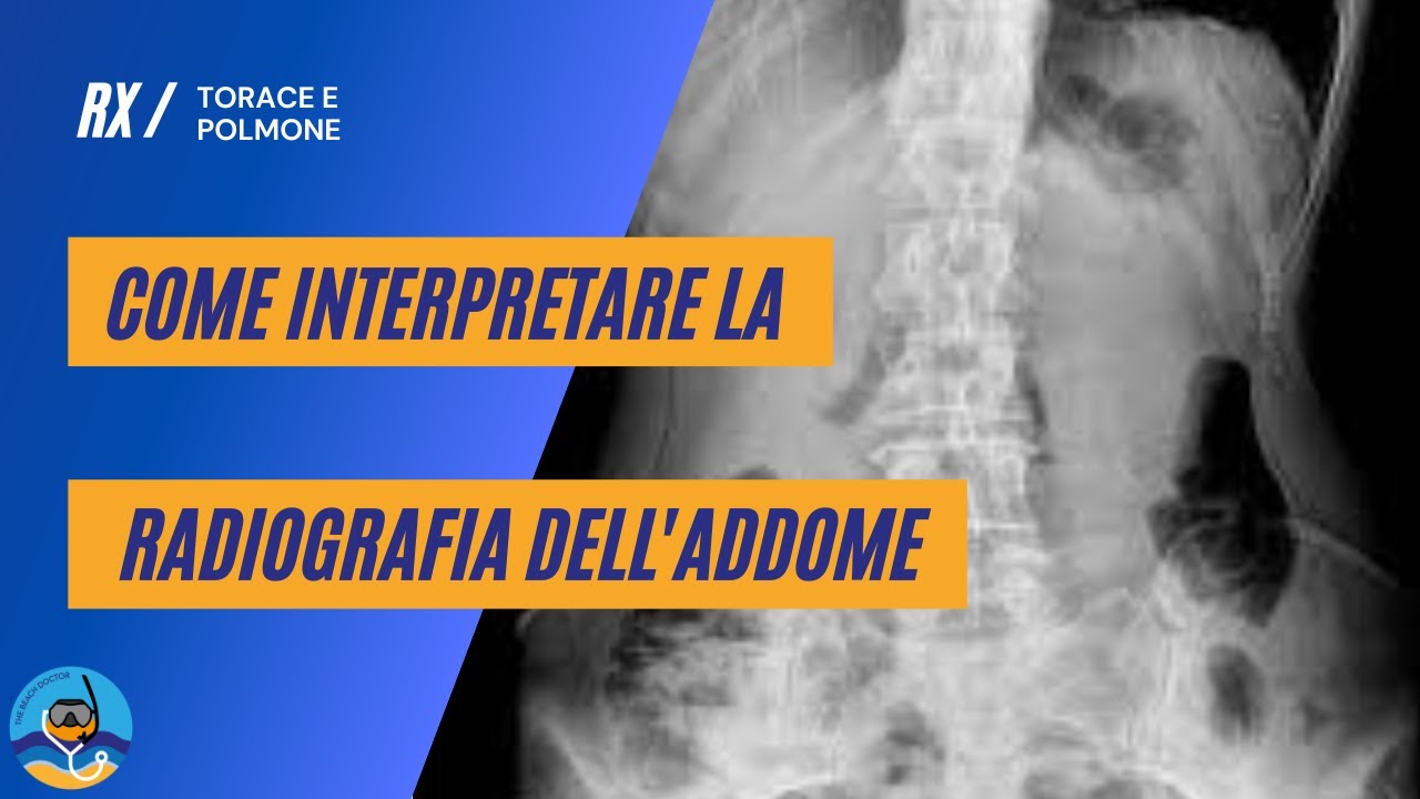 Come interpretare la radiografia dell'addome - YouTube