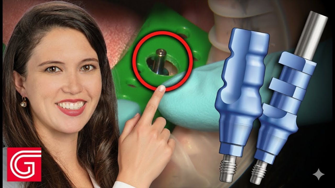 OPEN Tray VS CLOSED Tray IMPLANT Impression Technique - YouTube