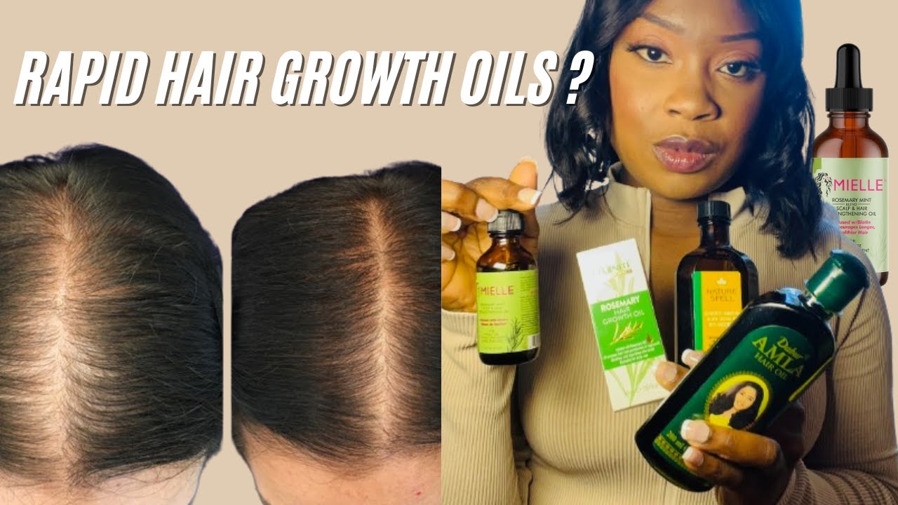 Best Hair Growth OILS for thinning hair! Rosemary oil, black Castor oil ...