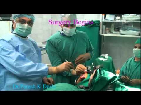 DBS Surgery for Parkinson's Disease | Dr. Paresh K Doshi - YouTube