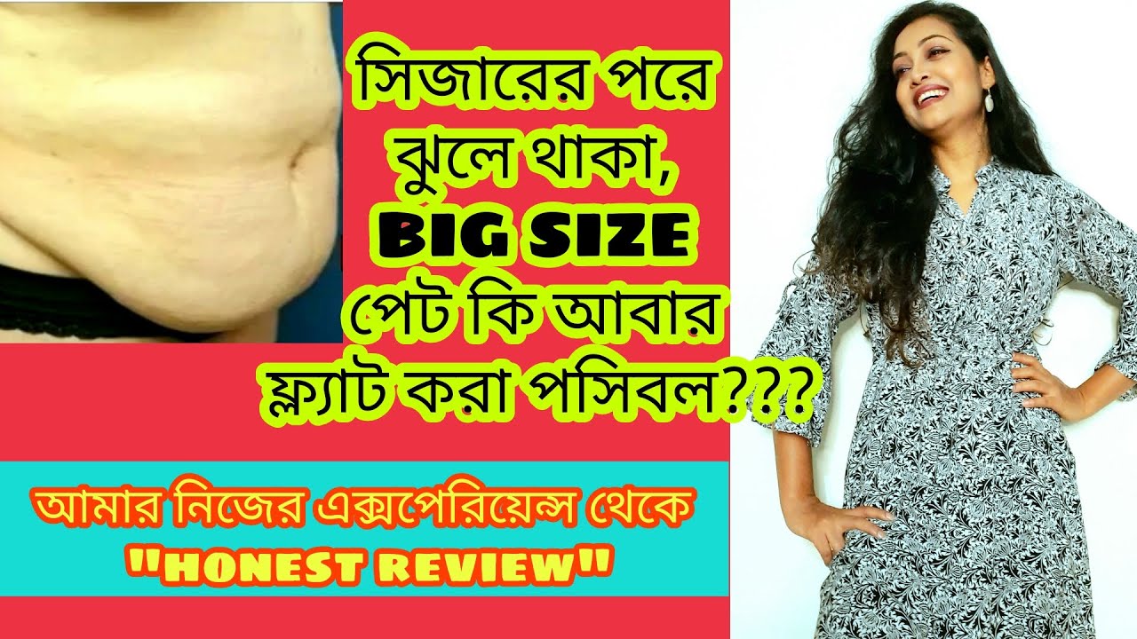 How to get "Flat Belly" after C-section?সিজারের পর ঝুলে যাওয়া, বড় পেট ...